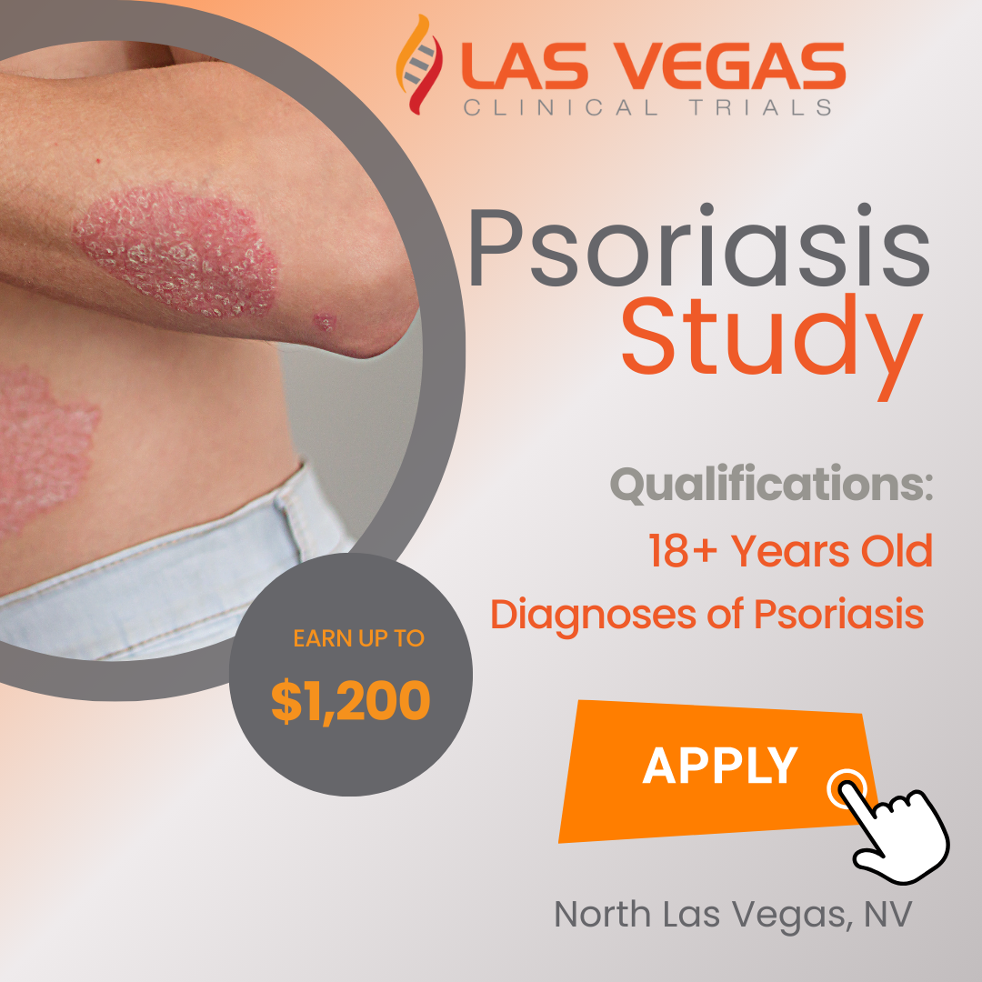 Moderate to Severe Psoriasis - North Las Vegas NV (Clinical Trial # 61602)